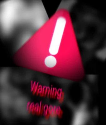 Image for The real gore warning template | Fandom