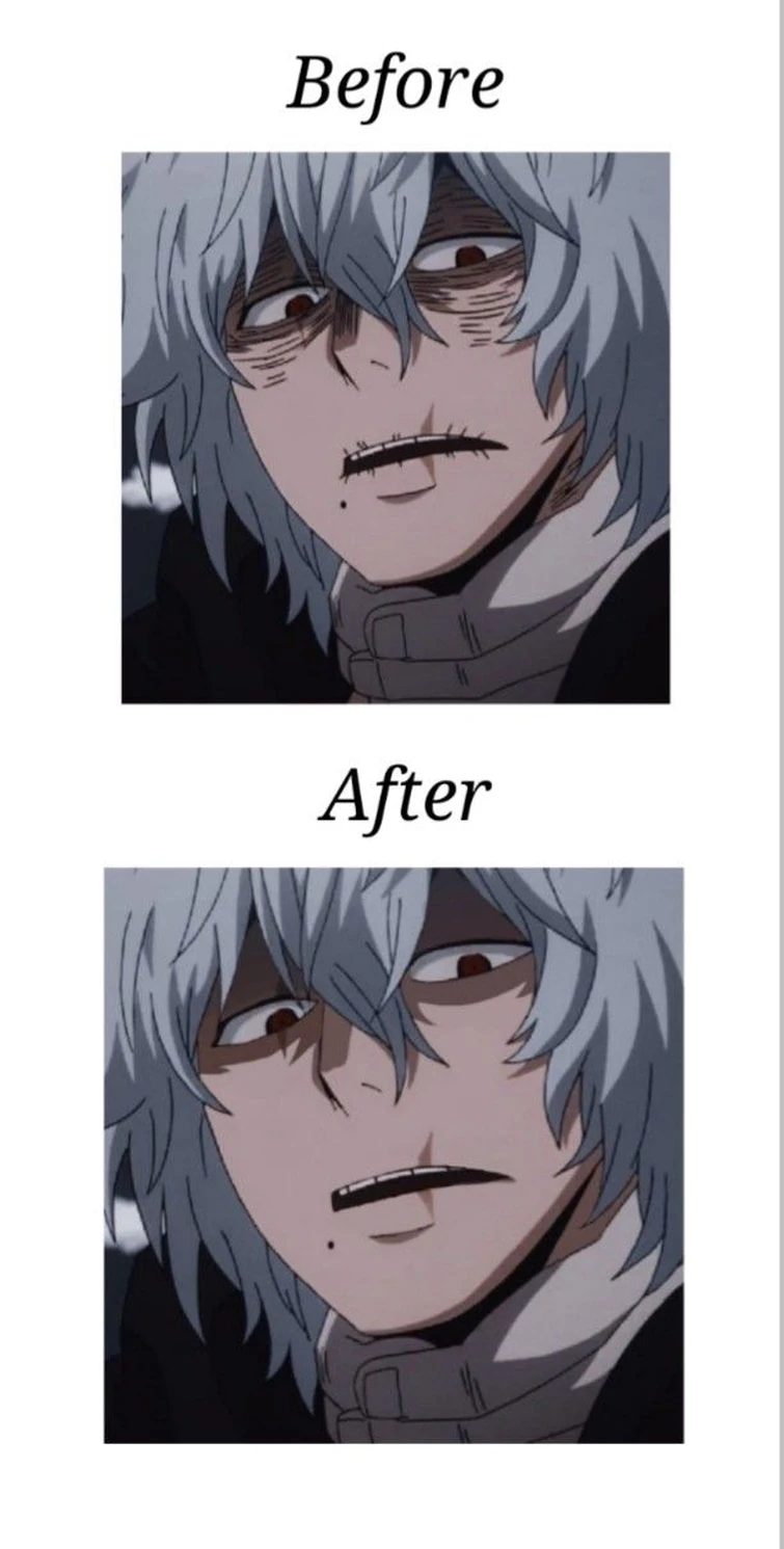 Is it just me or does Shigaraki need some Chapstick, CeraVe, lotion ...