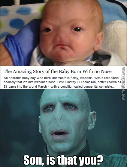 VOLDEMORT'S SON!!! | Fandom