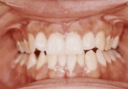 This is the mouth origin of SCP-087 B/Smile dog | Fandom