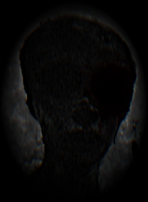 Remake of verst's most underrated thousand (imo) | Fandom