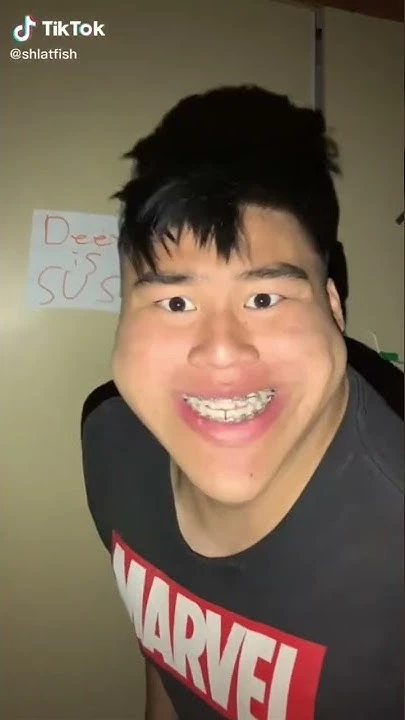 Deez nuts (this meme kills me) | Fandom