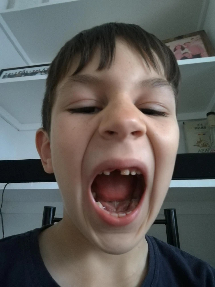 My tooth is gone | Fandom