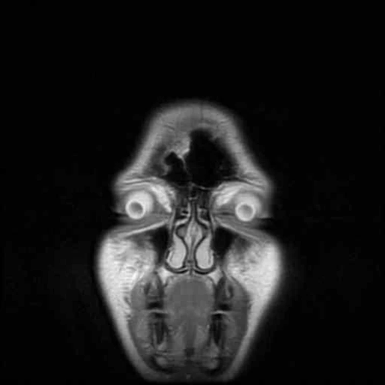 MRI Scan Images | Fandom