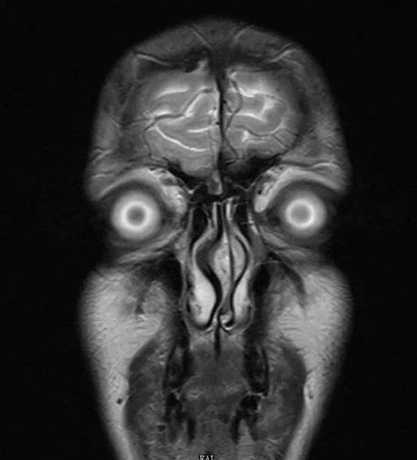 MRI Scan Images | Fandom