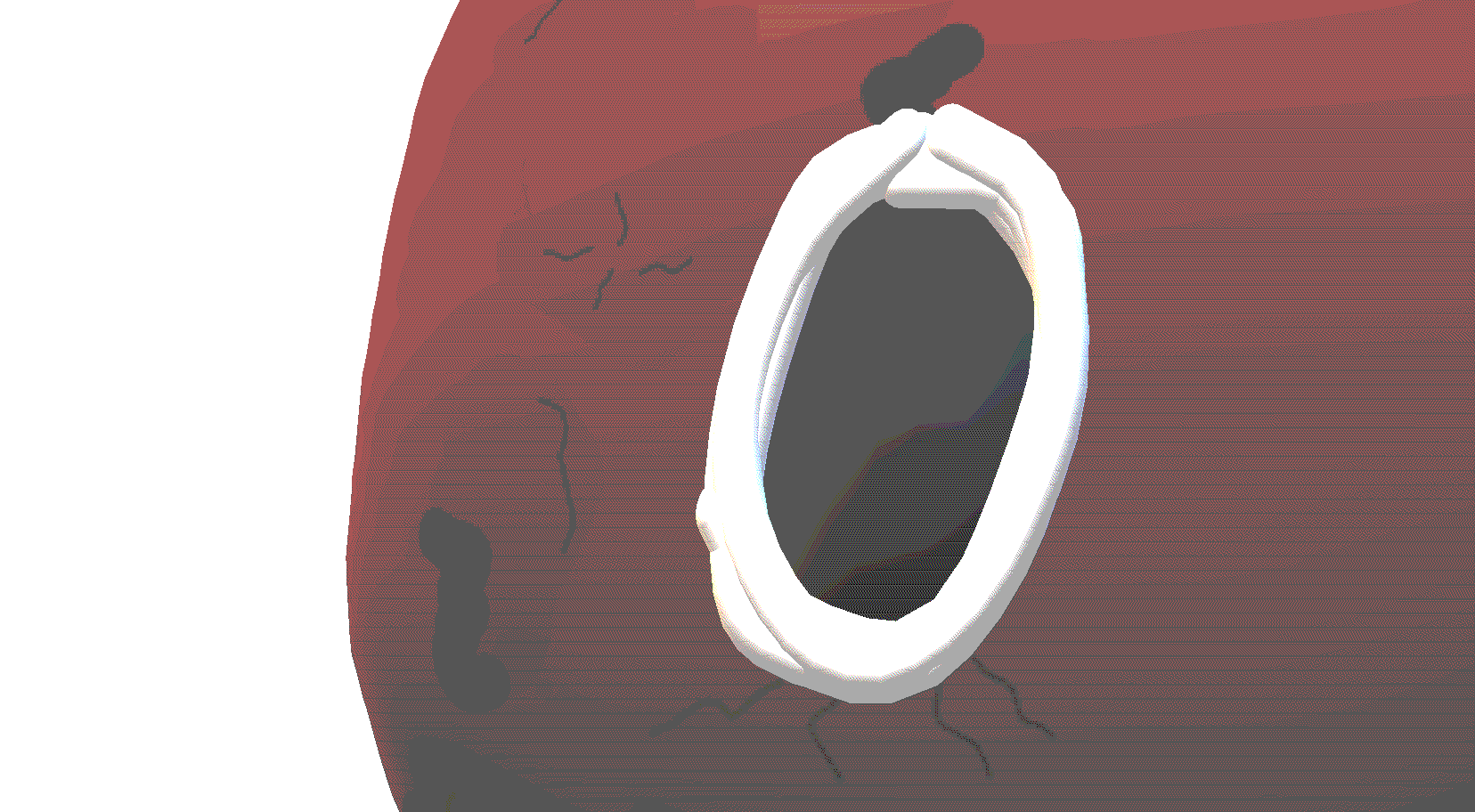 rotting away | Fandom