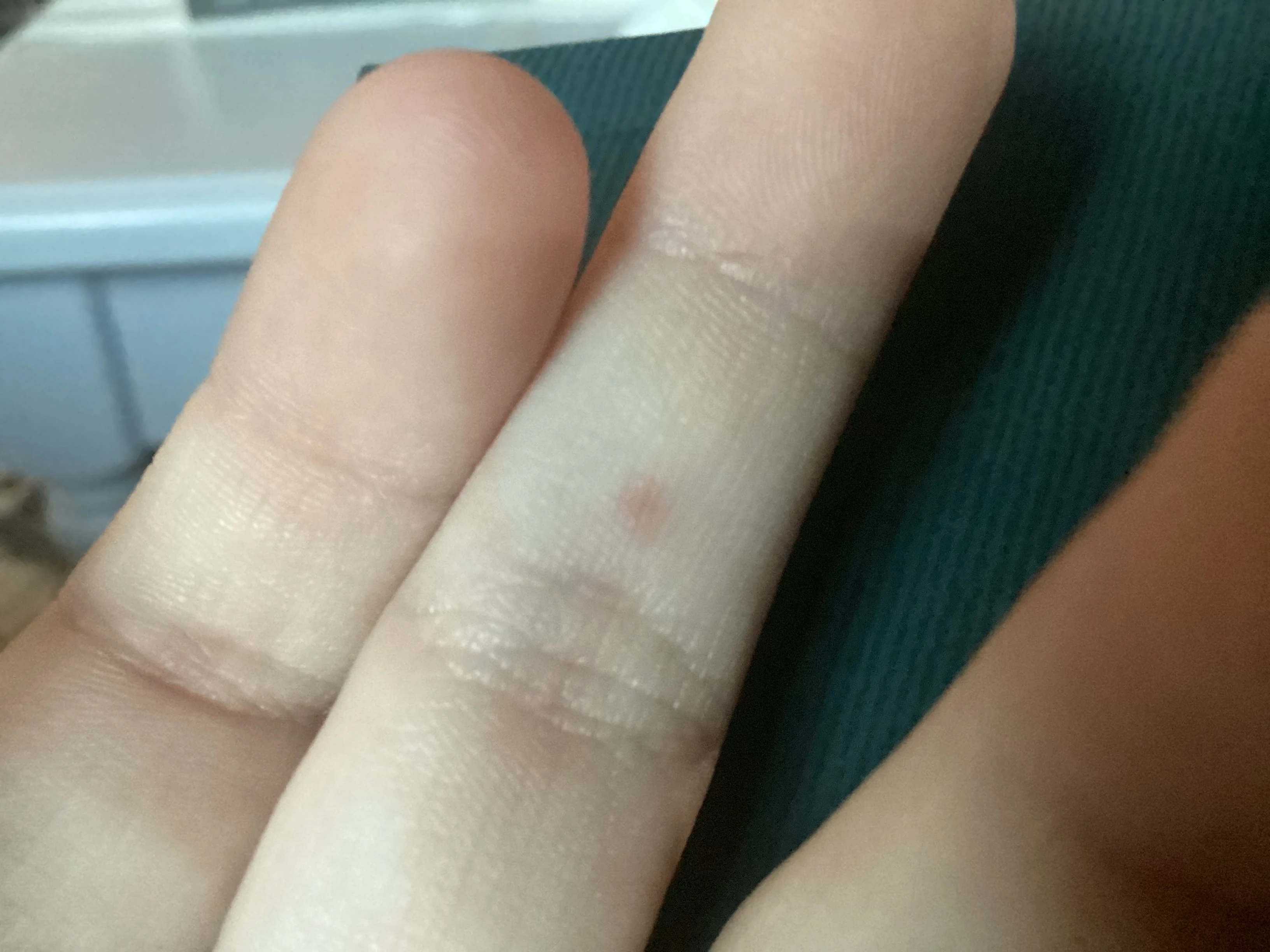 I think I got a splinter from my cat | Fandom