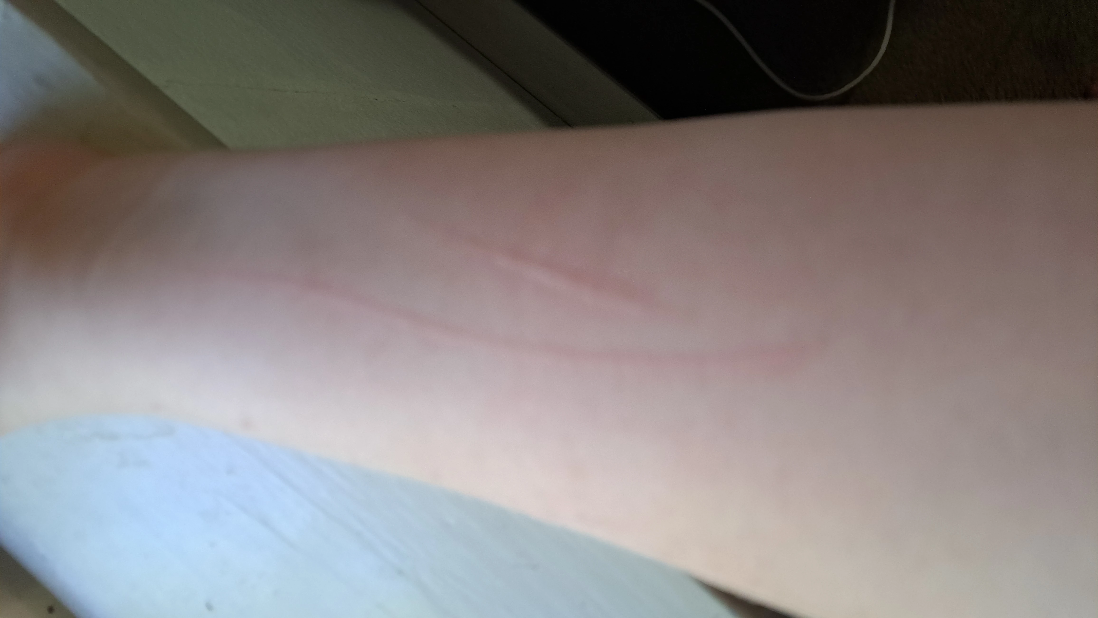 yeowch | Fandom