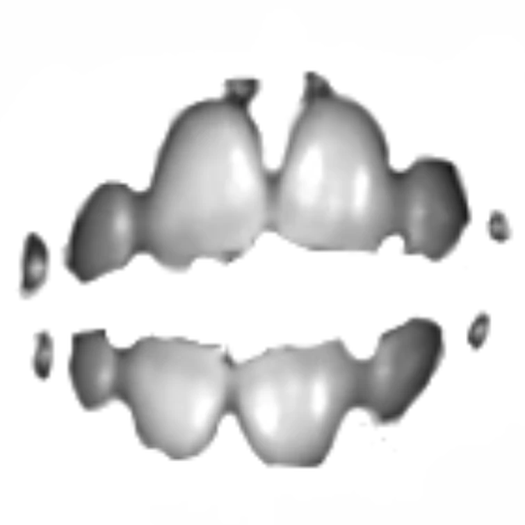 poorly cropped T-144 teeth,,,, | Fandom