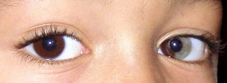 This is how I imagine Boq's eyes to look BTW | Fandom