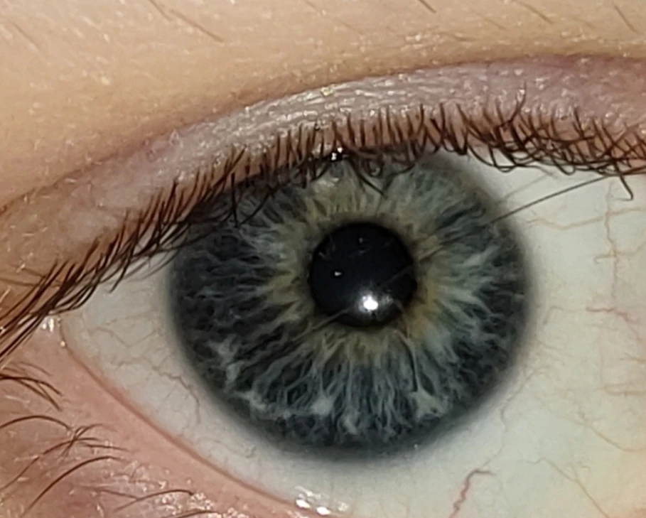 2k post eye reveal | Fandom