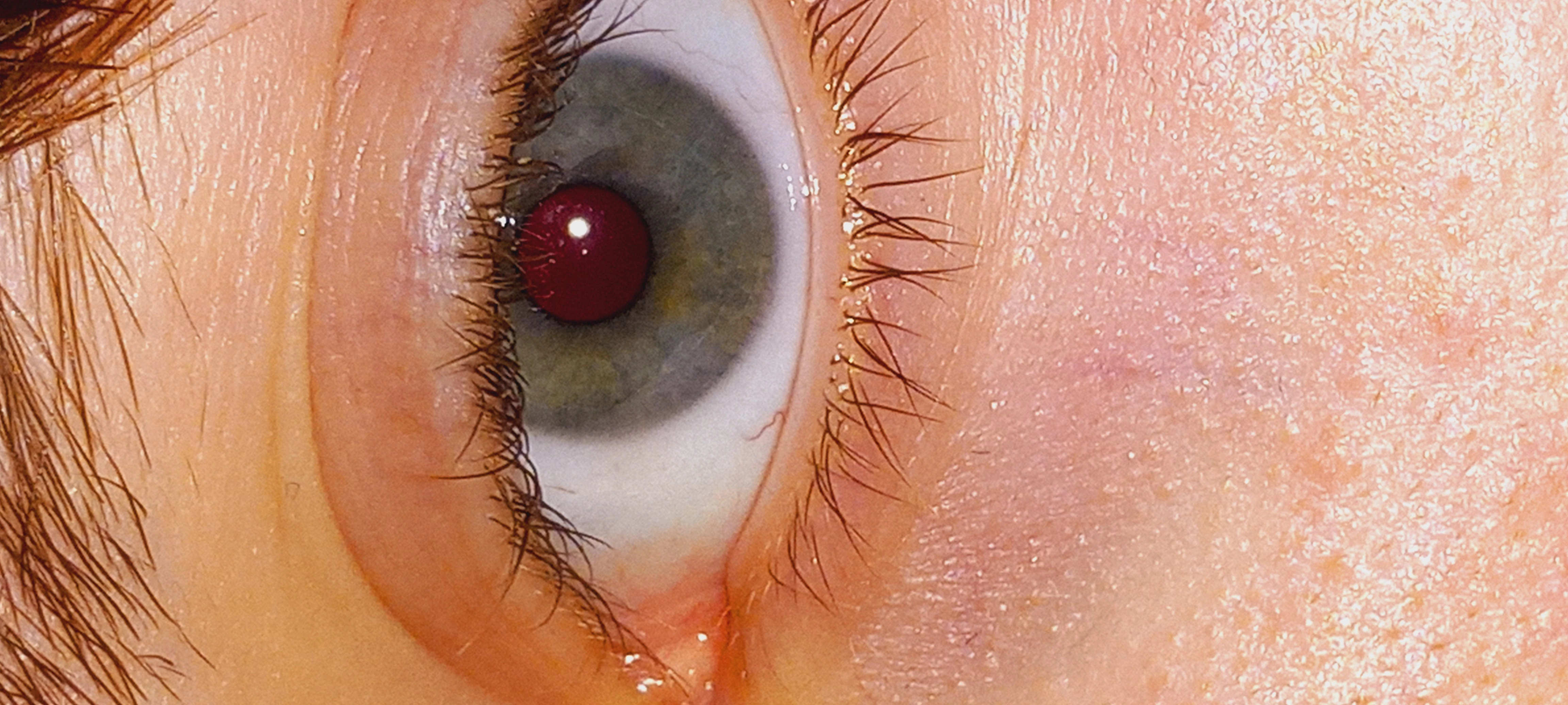 My eyes are so pretty //eyes?, upclose imaging | Fandom