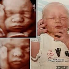 Logan and Chilly's daughter Lilly is due for her birth today. Lots of ...