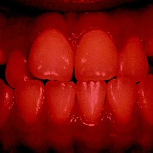 Gorecore playlist I made. | Fandom