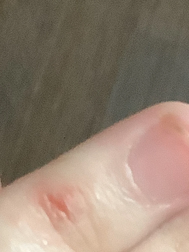 I got a cut on my finger… | Fandom