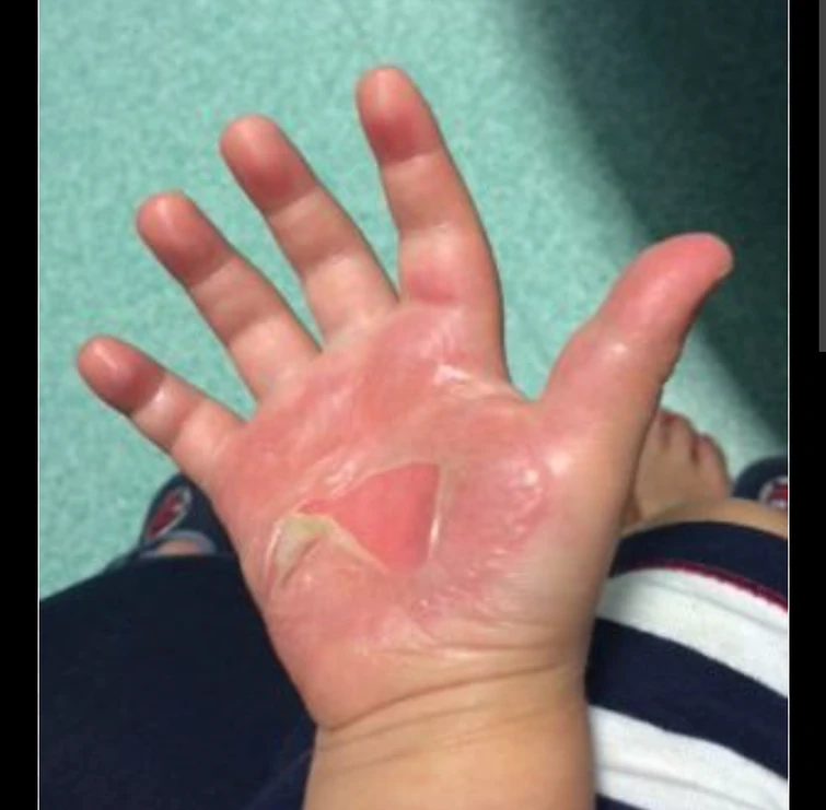 Humanized Naeus by Tuxel | Fandom