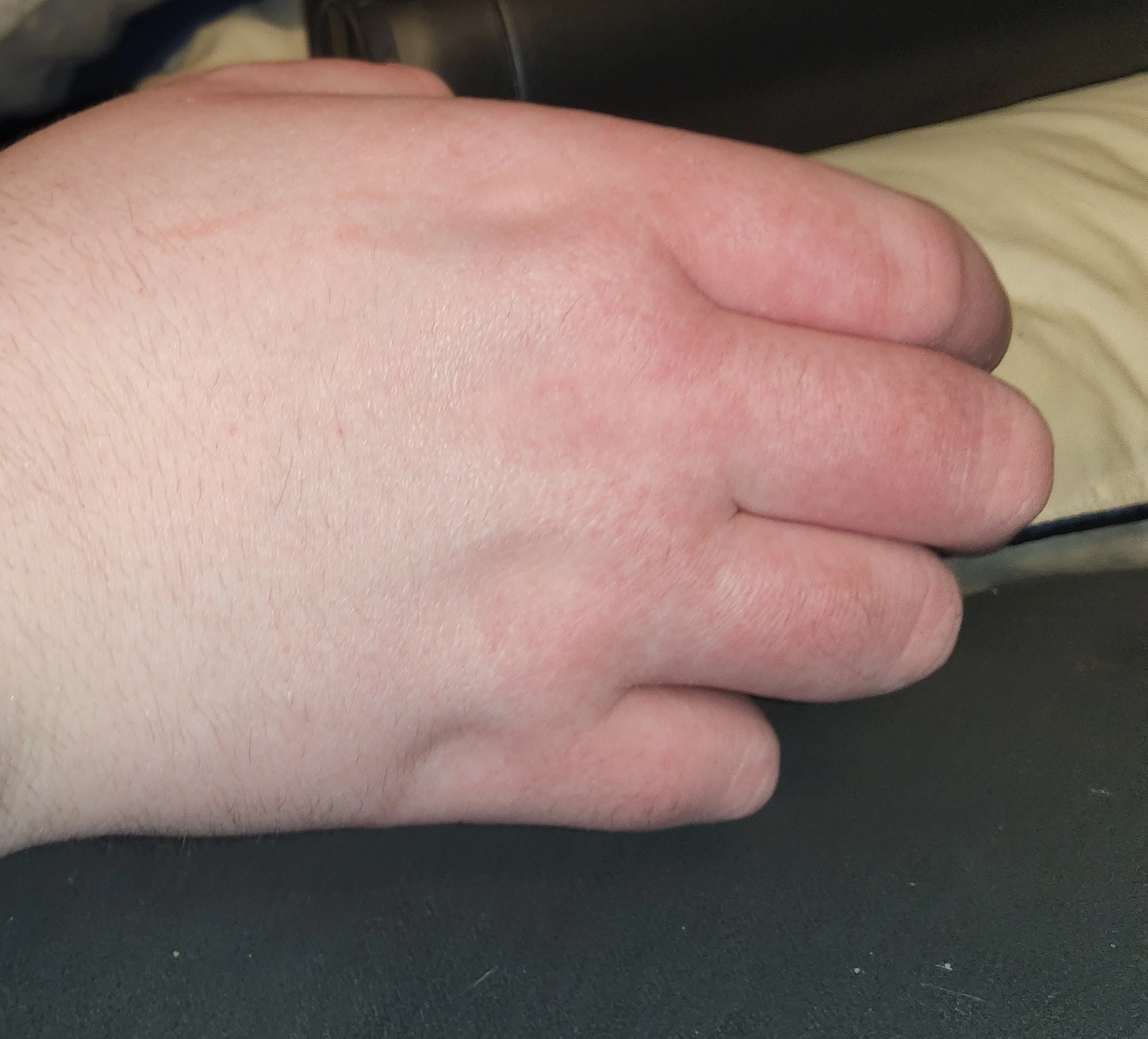 Anyone wanna tell me why my hand is so red- | Fandom