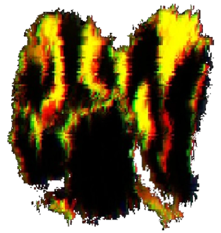 woah its xxxv-5 | Fandom