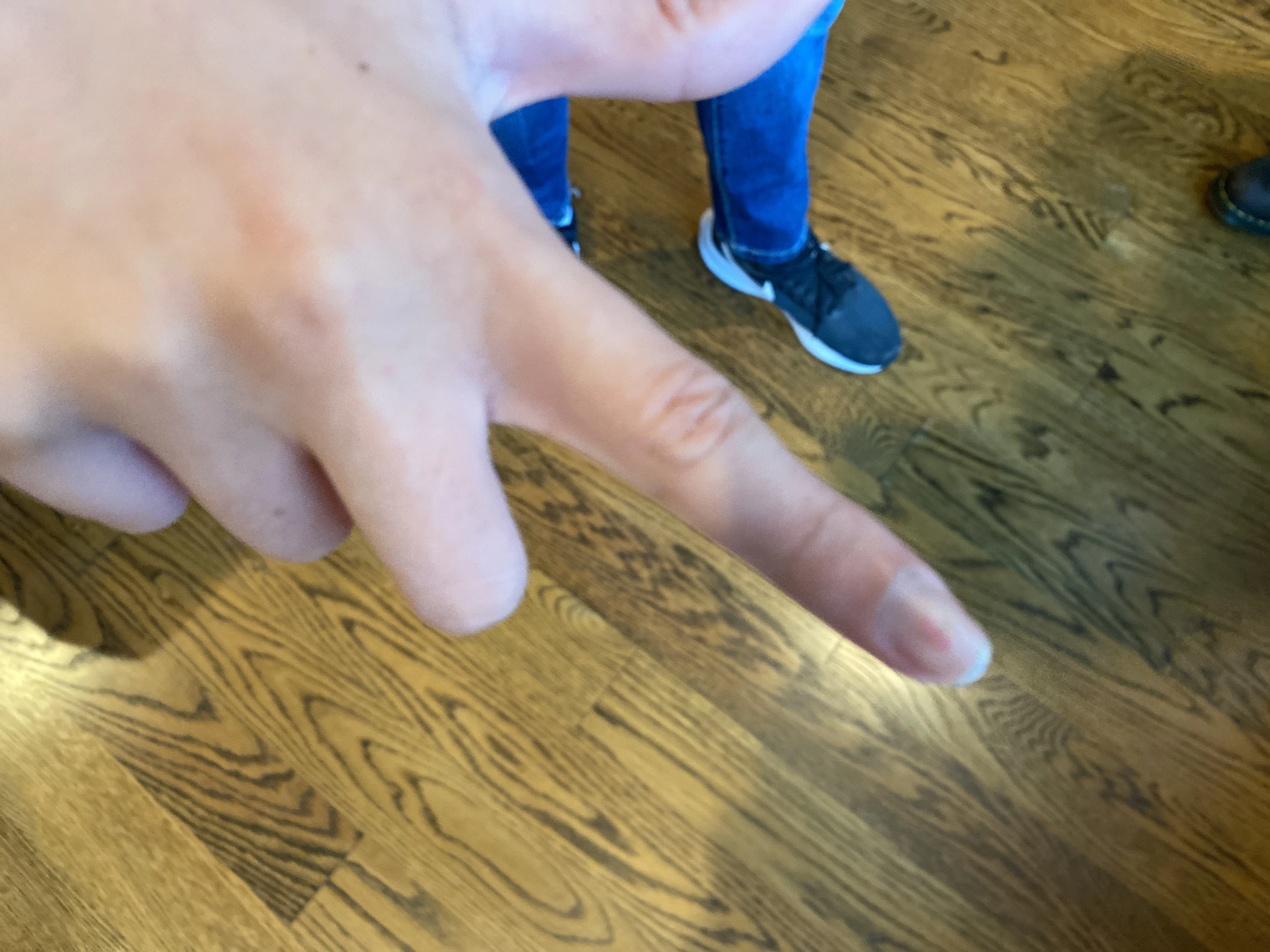 my best friend’s finger | Fandom