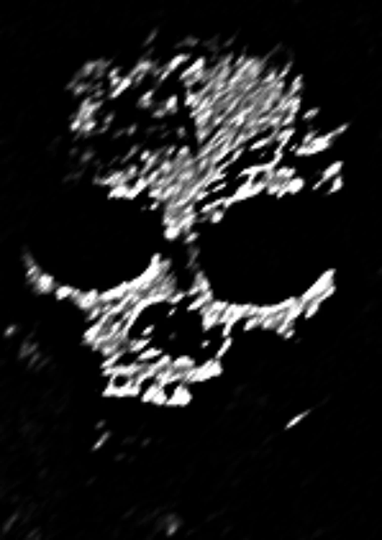 Made my own replacements of the gore phases in 31k - 50k | Fandom