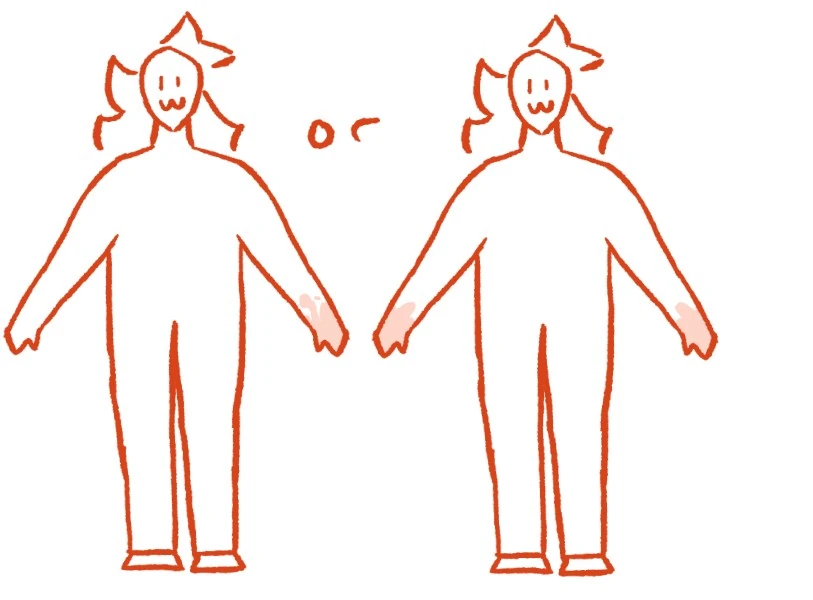 A guide to designing characters with vitiligo! | Fandom