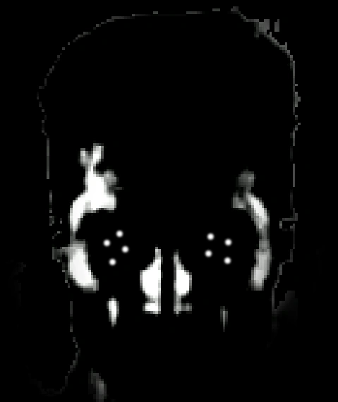 Here's the another 2 Phases for MIBU 250000 Phases. | Fandom