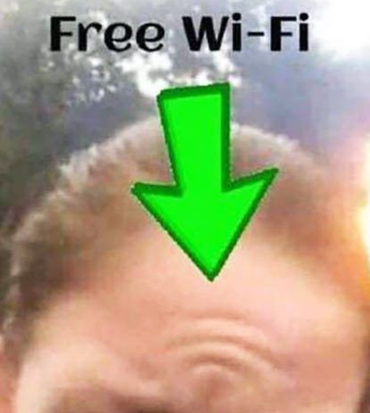 Big forehead | Fandom