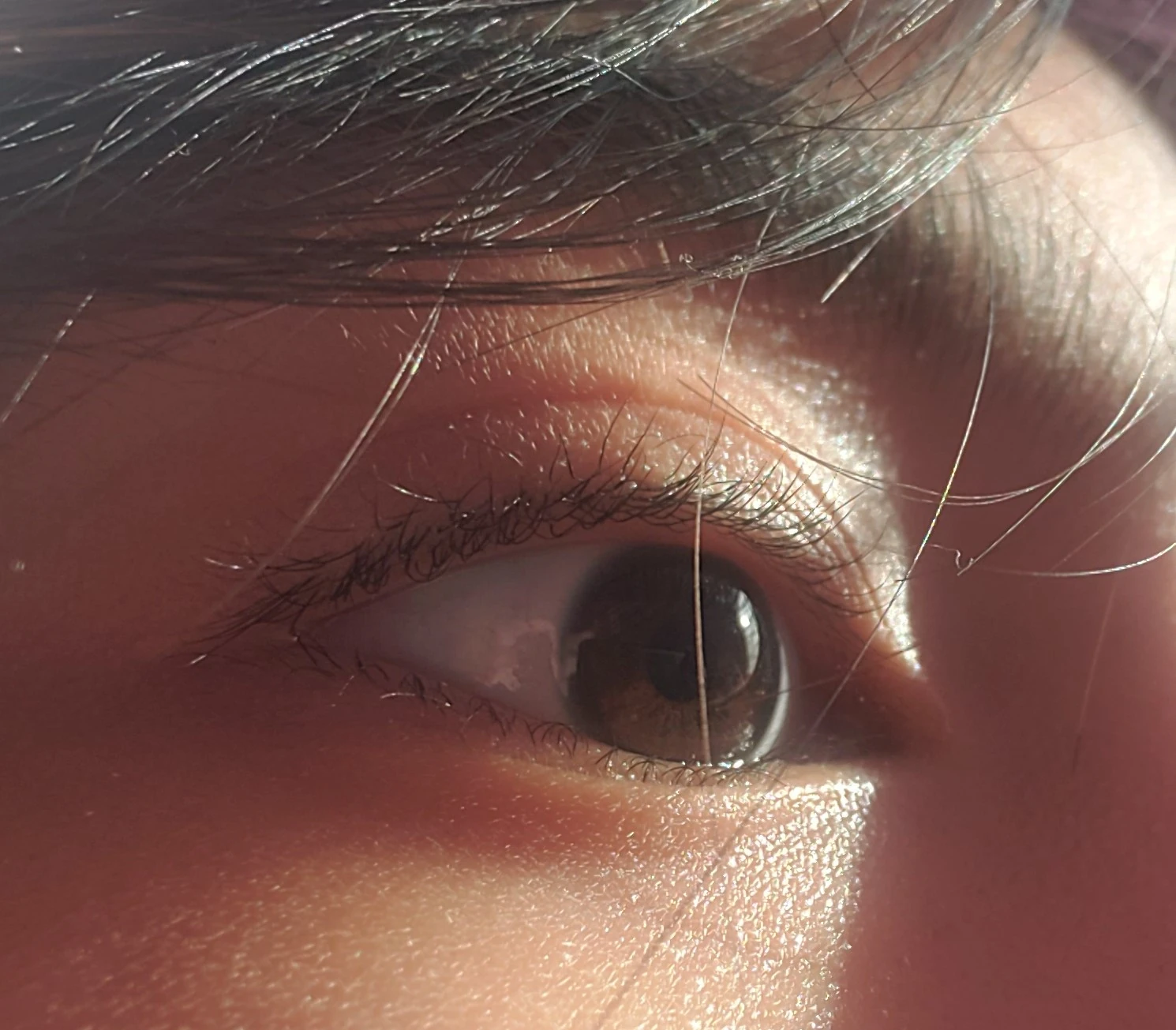 say Hi to my eyeball | Fandom