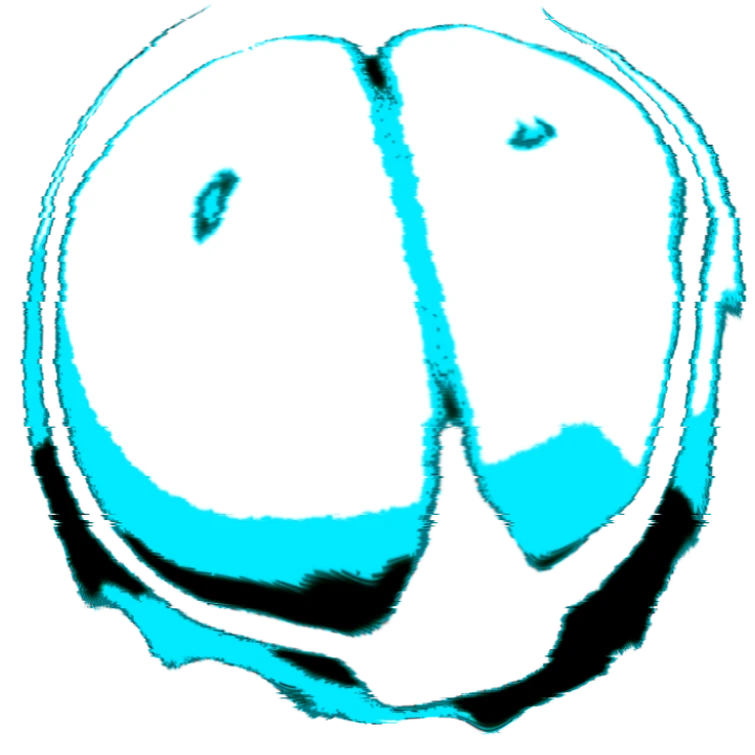 XXX-35: my version | Fandom