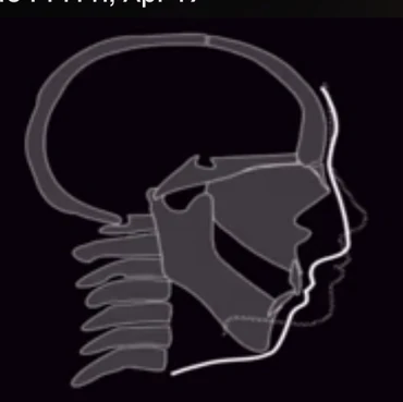 Mewing tutorial 101 by rodger?? | Fandom