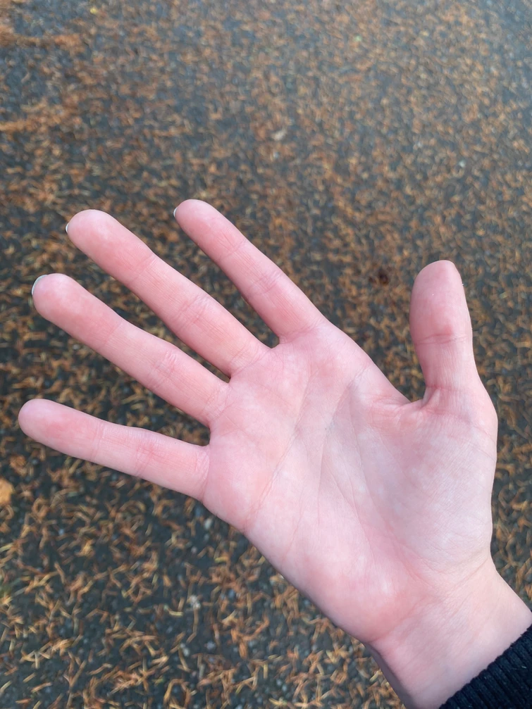 Should I do this? | Fandom