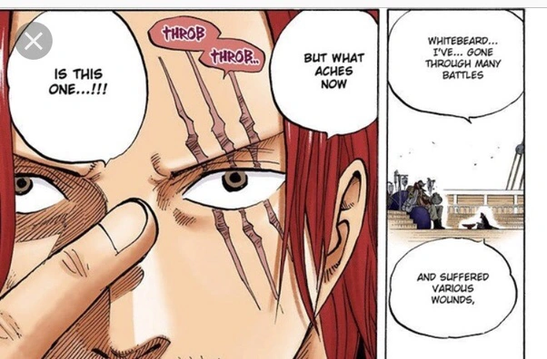 How did Blackbeard scar shanks? | Fandom