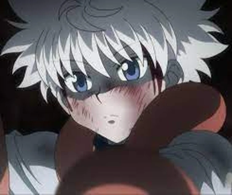 GASP an actual accurate killua art? (Tw for a bit of blood) | Fandom