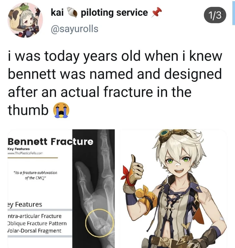 Fun (kinda sad ngl) Fact about bennett | Fandom