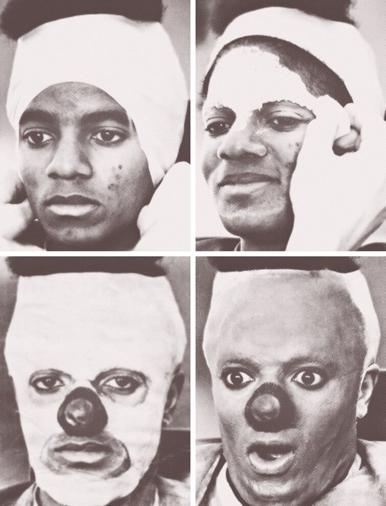 Michael Jackson Without Makeup | Saubhaya Makeup