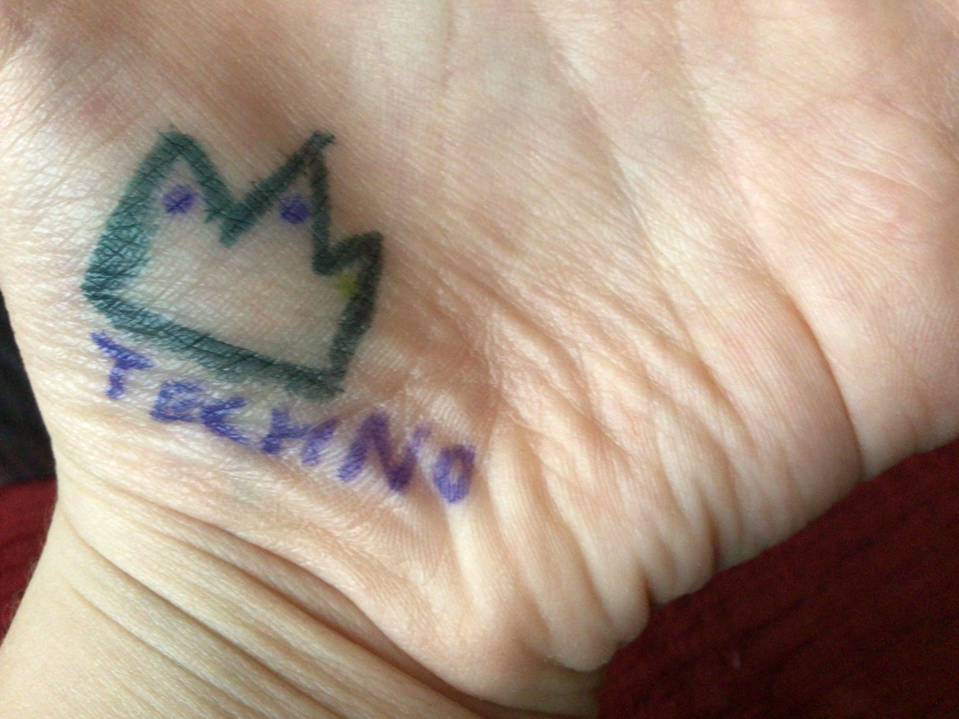 My techno hand. | Fandom