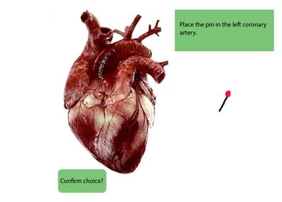 Spotter Test | Abertay Team 16 Wikia | Fandom