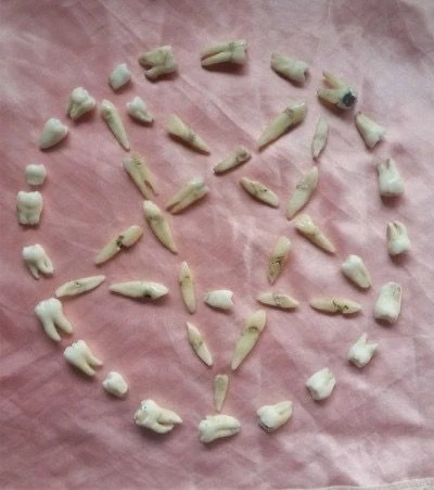 Teethcore | Aesthetics Wiki | Fandom