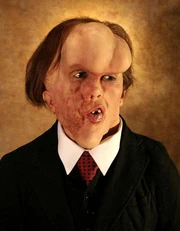 Joseph Merrick (Differently) | Alternative History | Fandom