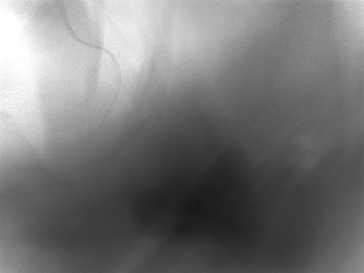 Karkoth Abaler | Ambodia Wiki | Fandom