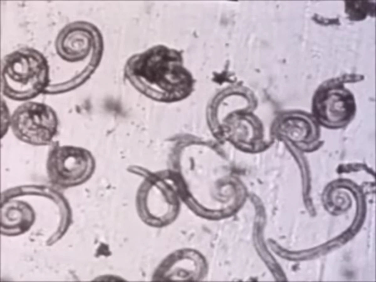 Tangi Virus | Analog Conditions and Diseases Wiki | Fandom