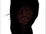 Pseudocoma (The Boiled One Phenomenon) | Analog Conditions and Diseases ...