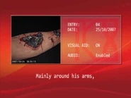 Pyritization Sickness | Analog Conditions and Diseases Wiki | Fandom