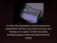 Pseudocoma (The Boiled One Phenomenon) | Analog Conditions and Diseases ...