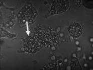 Tangi Virus | Analog Conditions and Diseases Wiki | Fandom