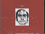 Smile Virus | Analog Conditions and Diseases Wiki | Fandom