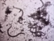 Tangi Virus | Analog Conditions and Diseases Wiki | Fandom