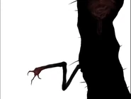 Pseudocoma (The Boiled One Phenomenon) | Analog Conditions and Diseases ...