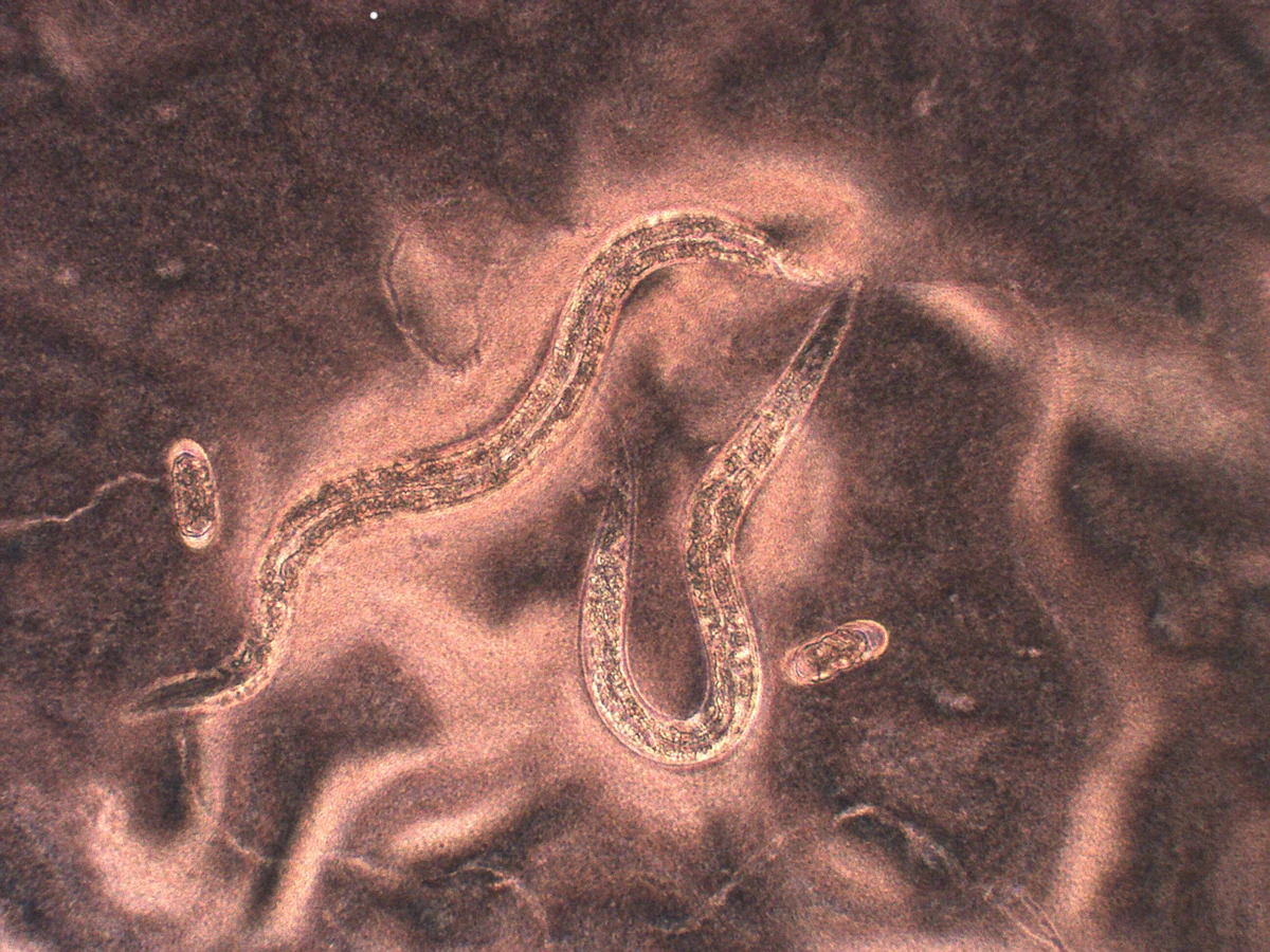 Roundworm | The Most Extreme Wiki | Fandom