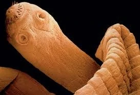 Tapeworm | Animals Wiki | Fandom